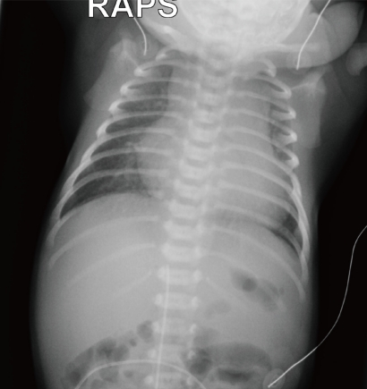 Clinical and Experimental Pediatrics