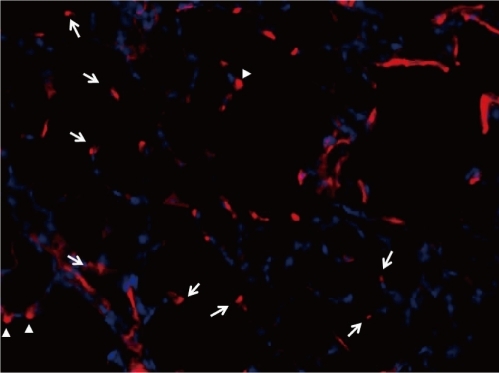 Lung interstitial cells during alveolarization